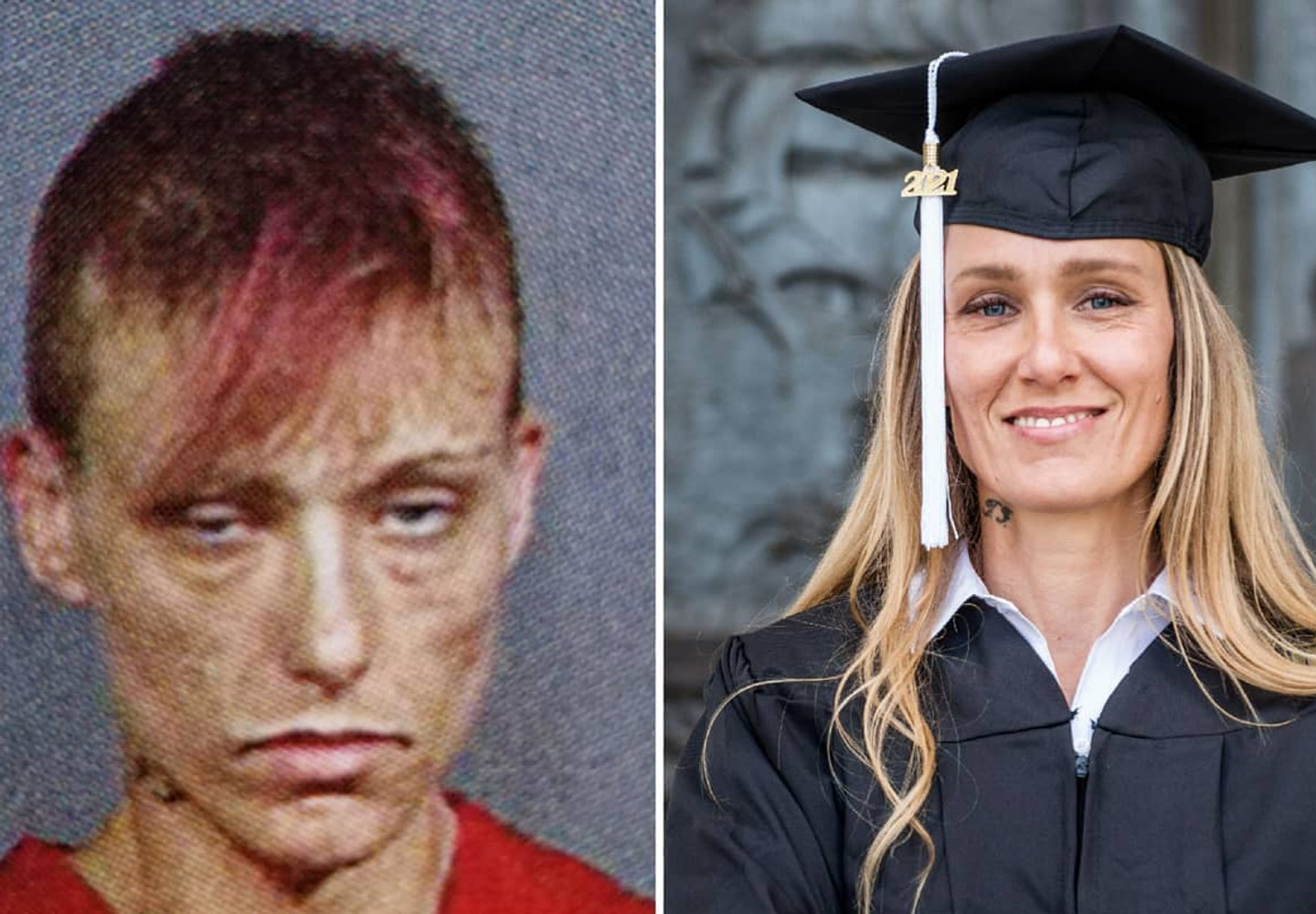 Effects of Meth Addiction on the Body - Excellence Recovery